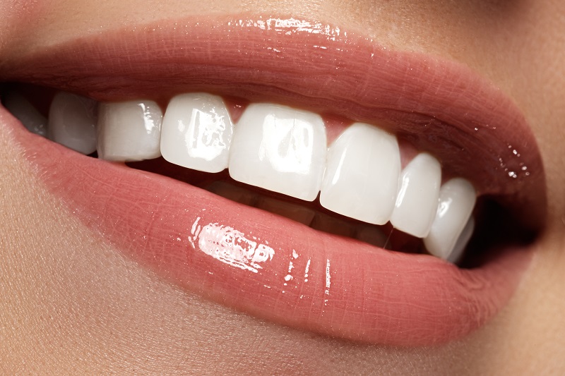 How a Smile Makeover Can Change the Shape of Your Face | Haider Family ...